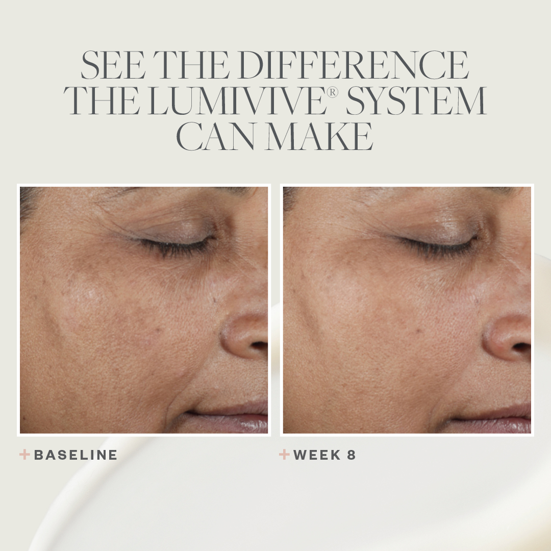 SkinMedica® Lumivive® System - Baked Bar The Holistic Medspa